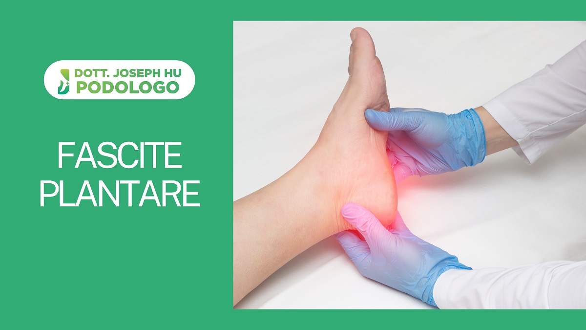 Fascite plantare – Podologo